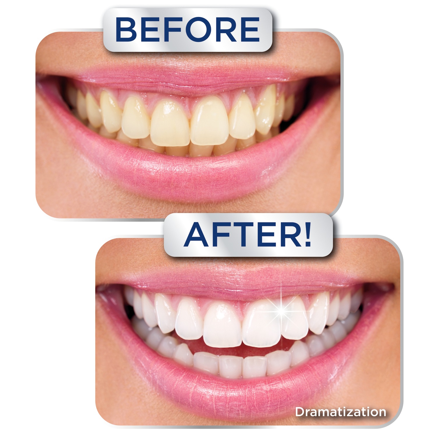 Miracle Smile Teeth Whitening Gel | Healthy Living