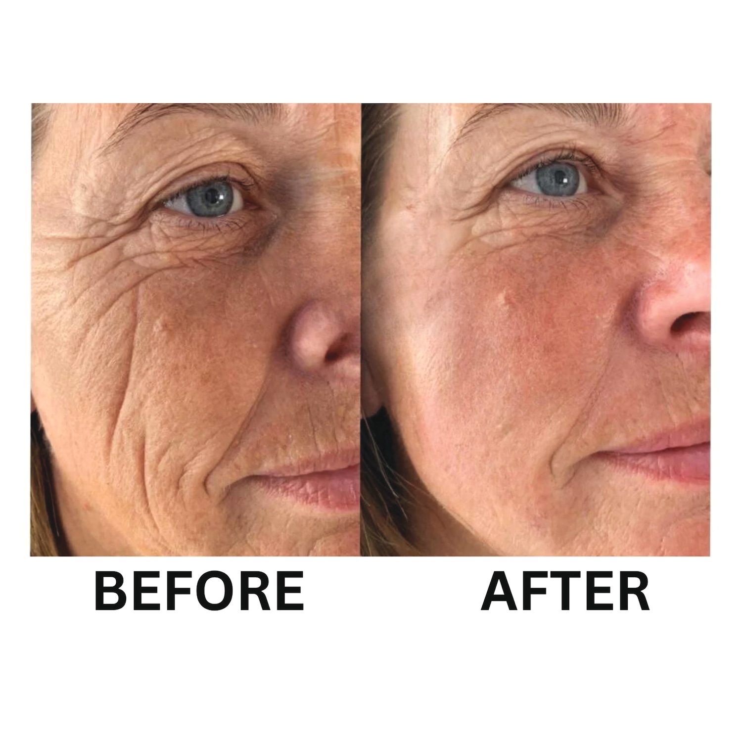 Deep Wrinkle Anti-Aging Cream | Healthy Living